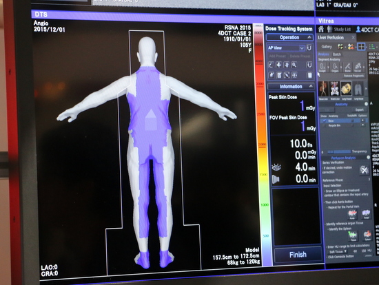 メディカルwatch » Blog Archive » INFINIX 4DCT ANGIO SUITE