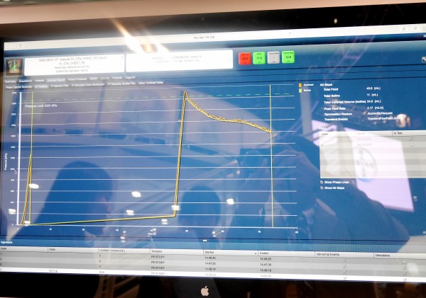 メディカルwatch » Blog Archive » Radimetrics