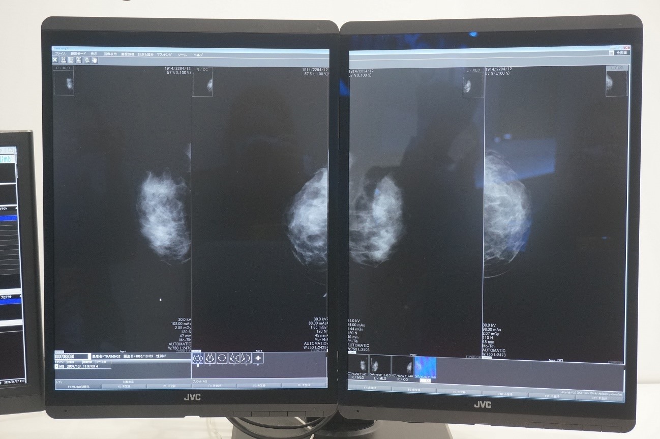 メディカルwatch » Blog Archive » JVC s500モニター