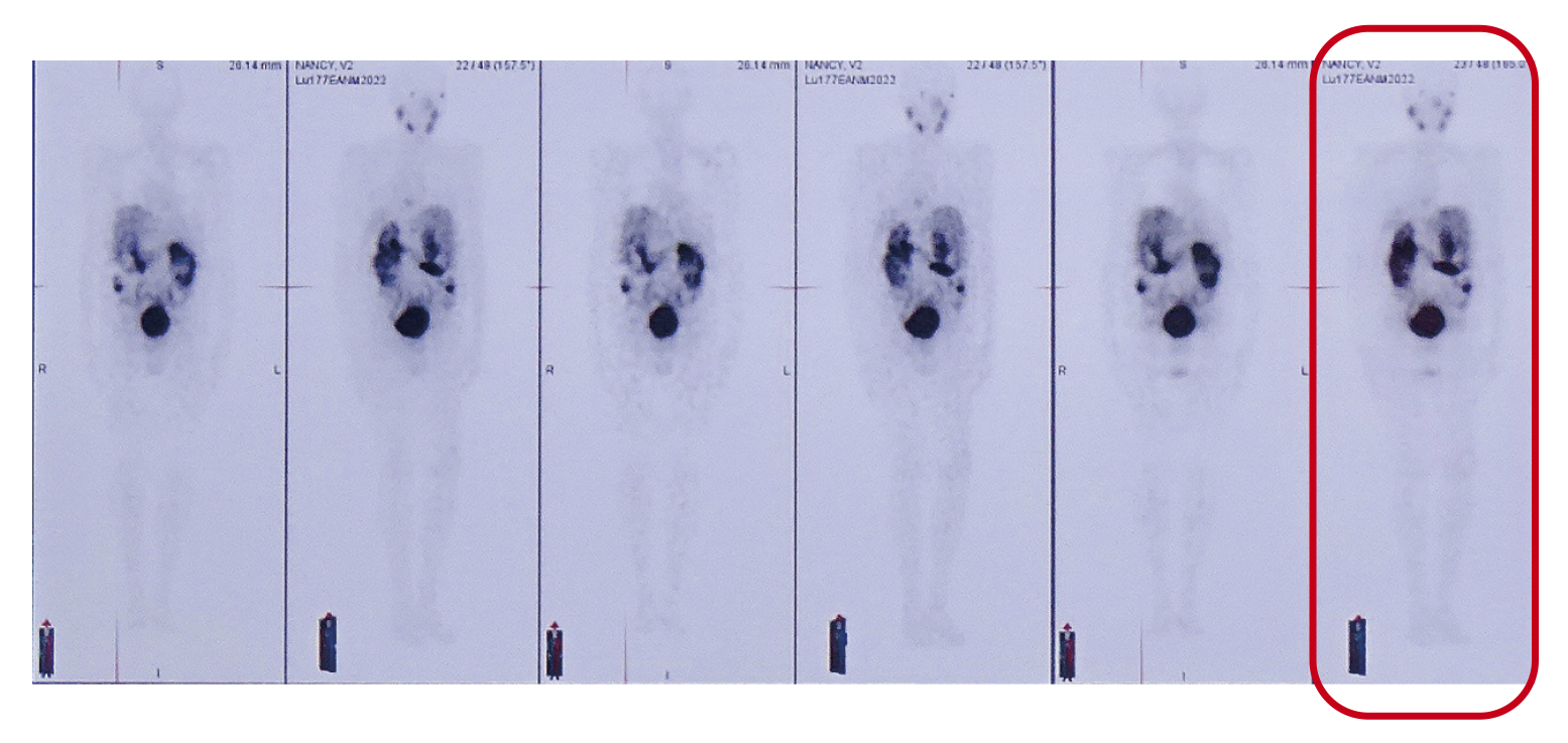 メディカルwatch » Blog Archive » 【ITEM2024取材速報】Spectrum Dynamics Medical ...